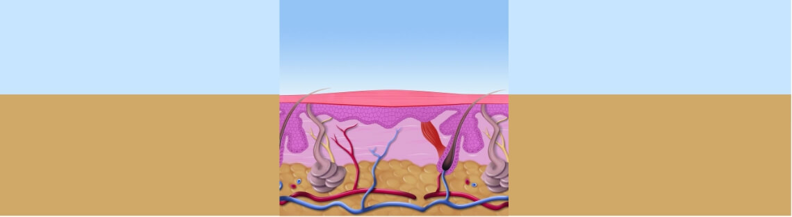 Swift Treatment Overview - Leigham Practice Therapies & Treatments